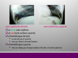 Técnica radiográfica en neumología | PPT