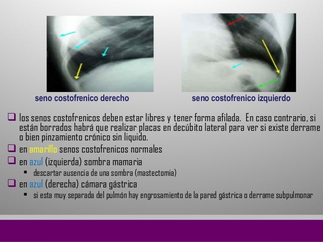 Técnica radiográfica en neumología