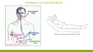 Post surgery Nutrition- Semi elemental Formula | PPT