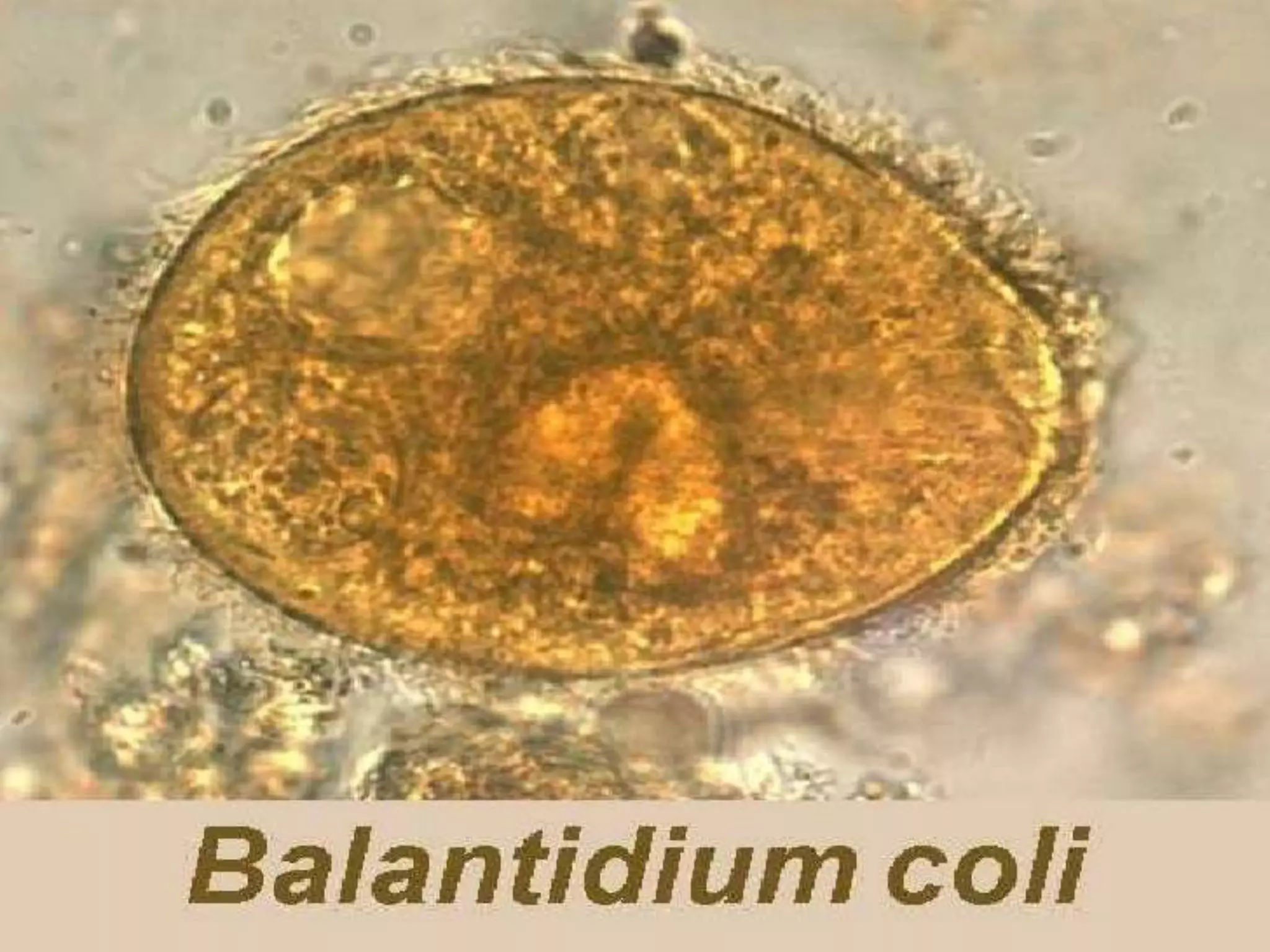 Balantidium Coli Ppt