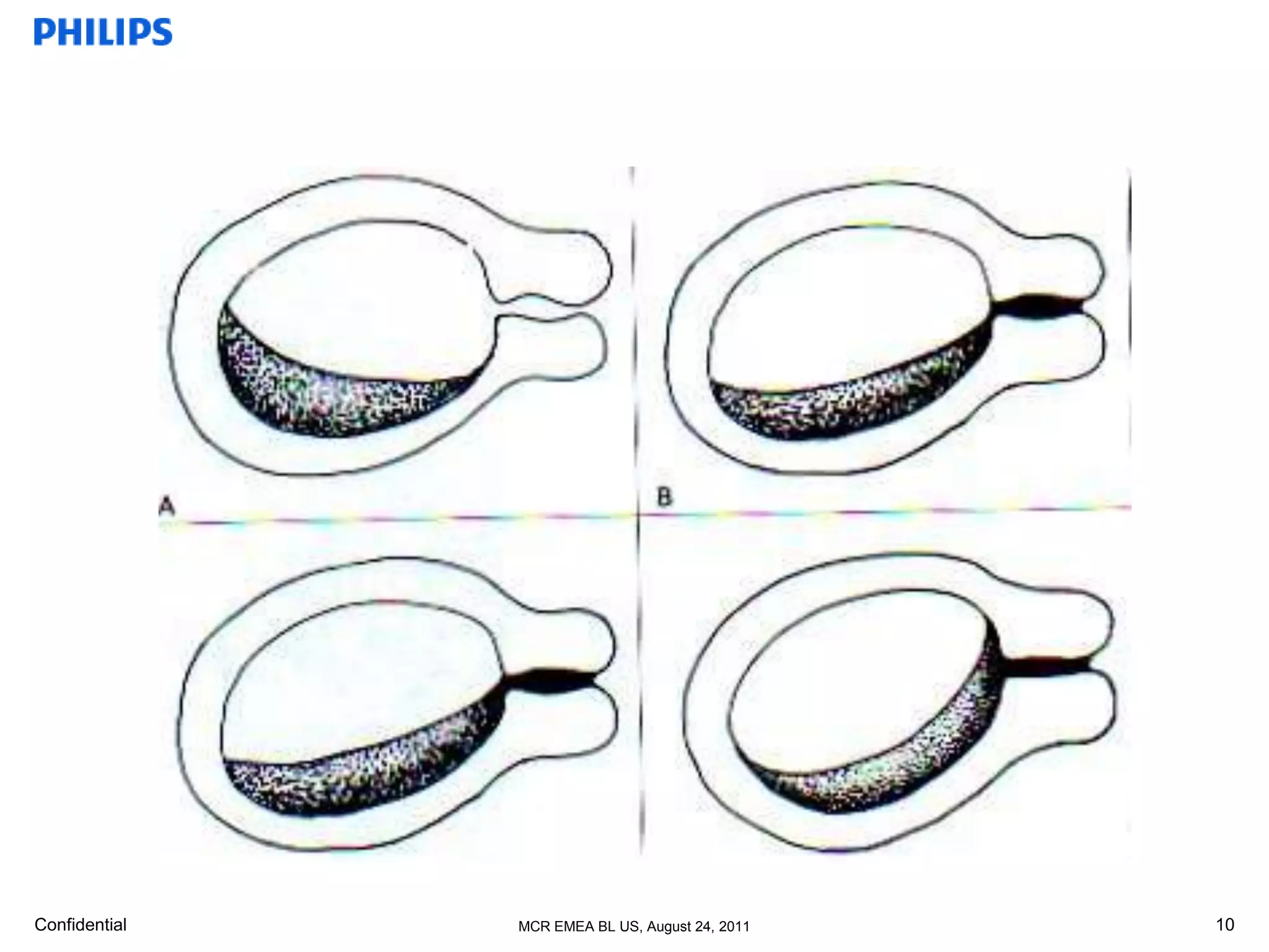basic anatomy ob & gyn | PPTX