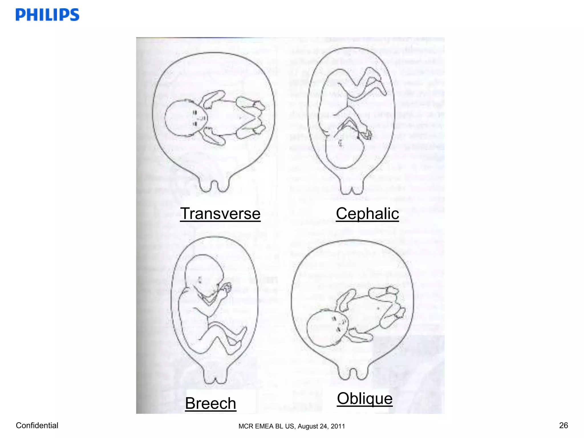 basic anatomy ob & gyn | PPTX