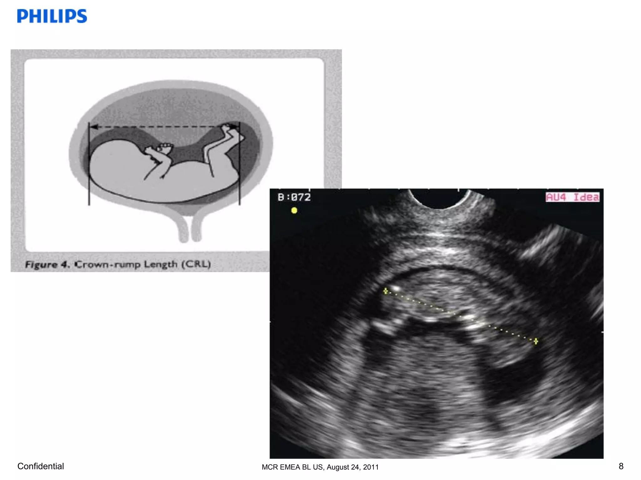 basic anatomy ob & gyn | PPTX