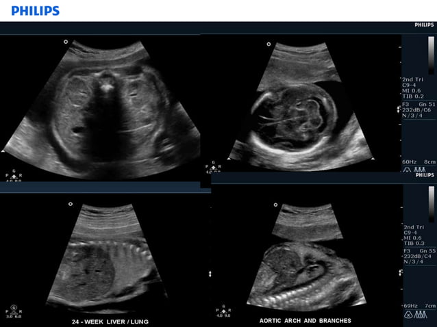 basic anatomy ob & gyn | PPTX