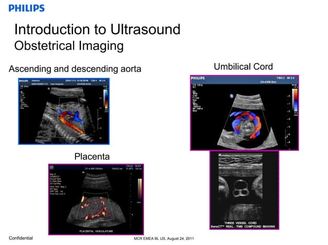 basic anatomy ob & gyn | PPT