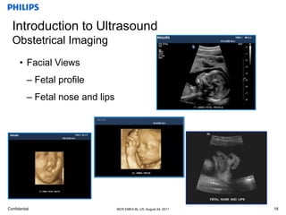 basic anatomy ob & gyn | PPTX