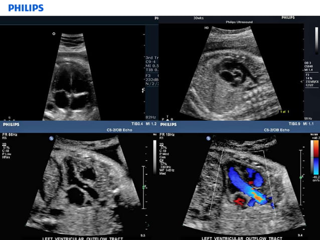 basic anatomy ob & gyn | PPTX