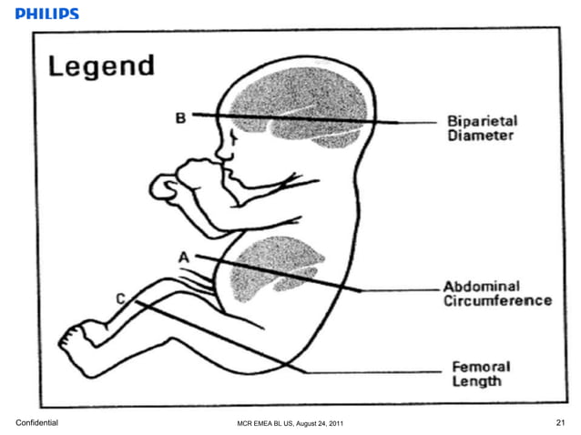 basic anatomy ob & gyn | PPT | Free Download