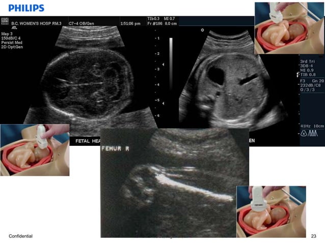basic anatomy ob & gyn | PPTX