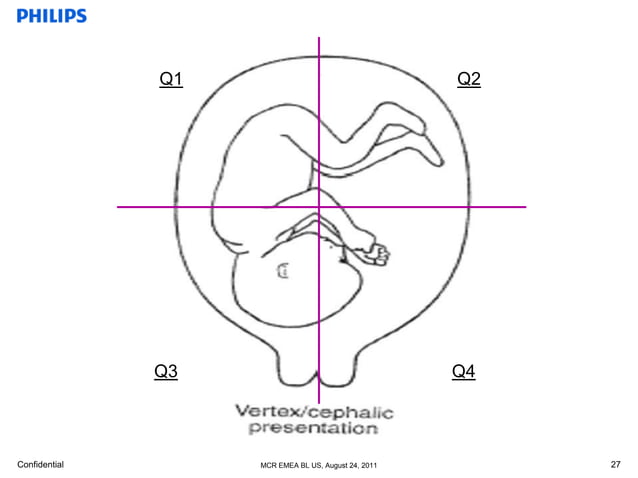 basic anatomy ob & gyn | PPTX