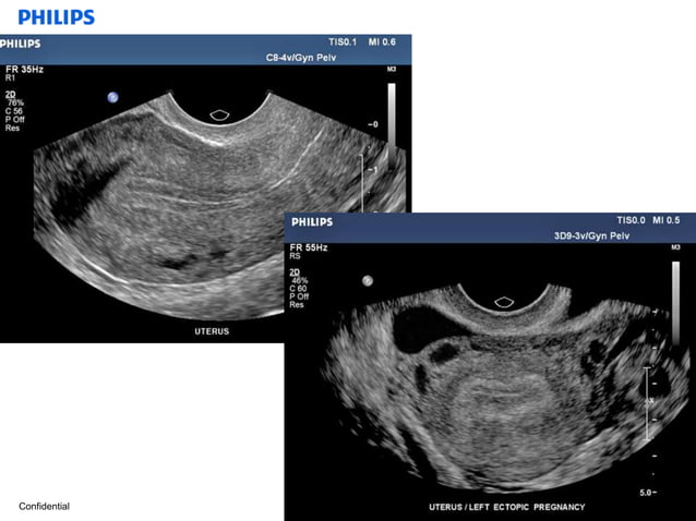 basic anatomy ob & gyn | PPTX