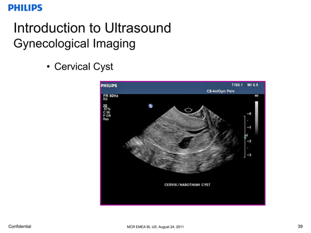 basic anatomy ob & gyn | PPTX