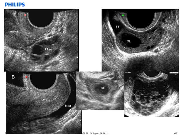 basic anatomy ob & gyn | PPTX