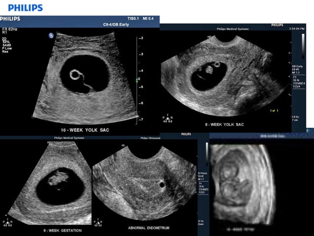 basic anatomy ob & gyn | PPTX