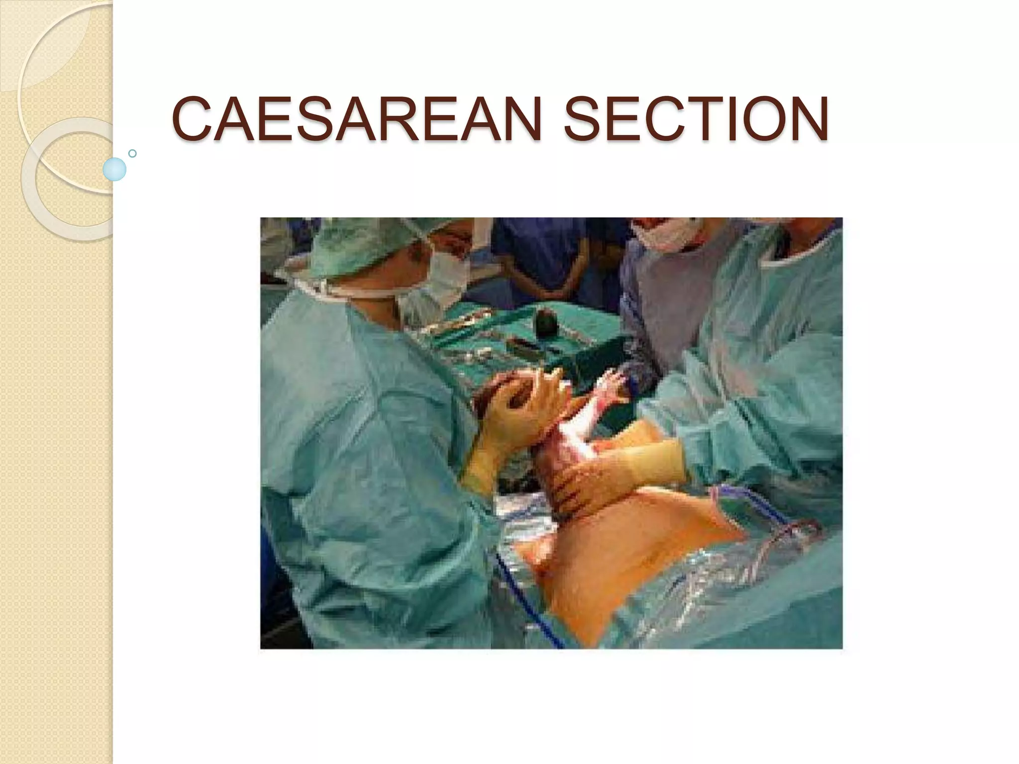 3_Basics of Caesarean Section.pptx