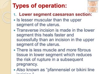 3_Basics of Caesarean Section.pptx