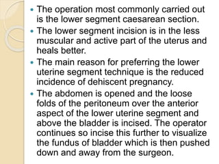 3_Basics of Caesarean Section.pptx