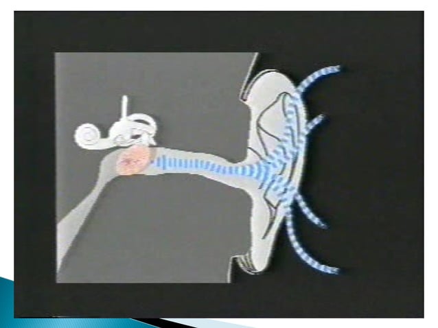 3 (b) pathology,disorders of outer, middle and inner ear | PPT