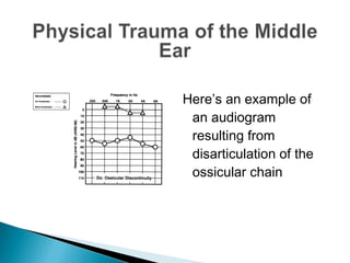 3 (b) pathology,disorders of outer, middle and inner ear | PPT