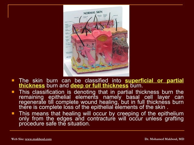 3 Burn Management | PPT | First Aid | Injuries