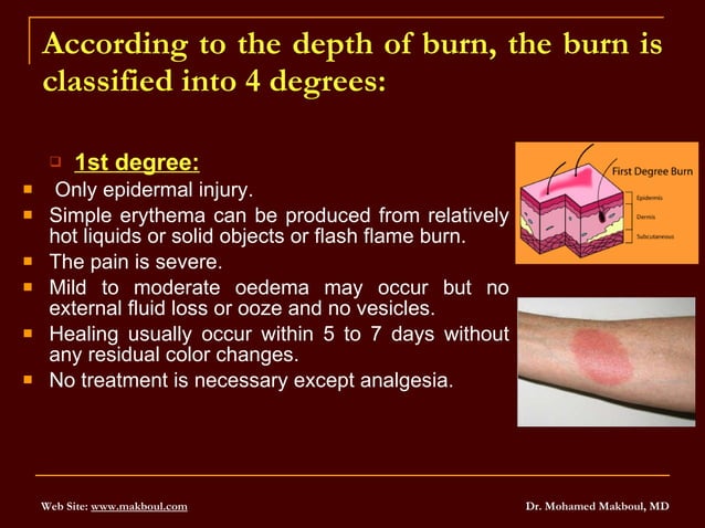 3 Burn Management | PPT | First Aid | Injuries
