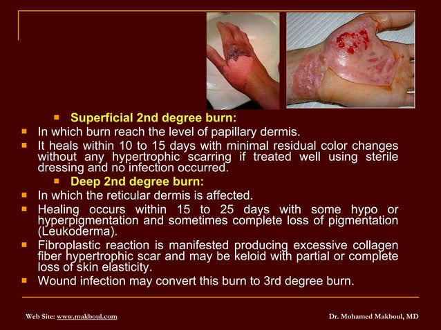 3 Burn Management | PPT | First Aid | Injuries