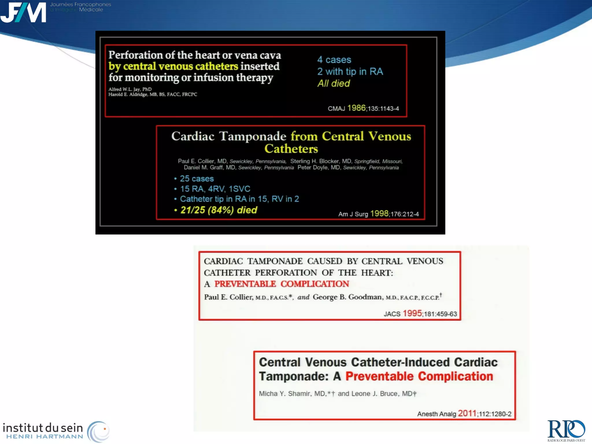 Catheter tip positioning control in chest port implantation. Luc ...