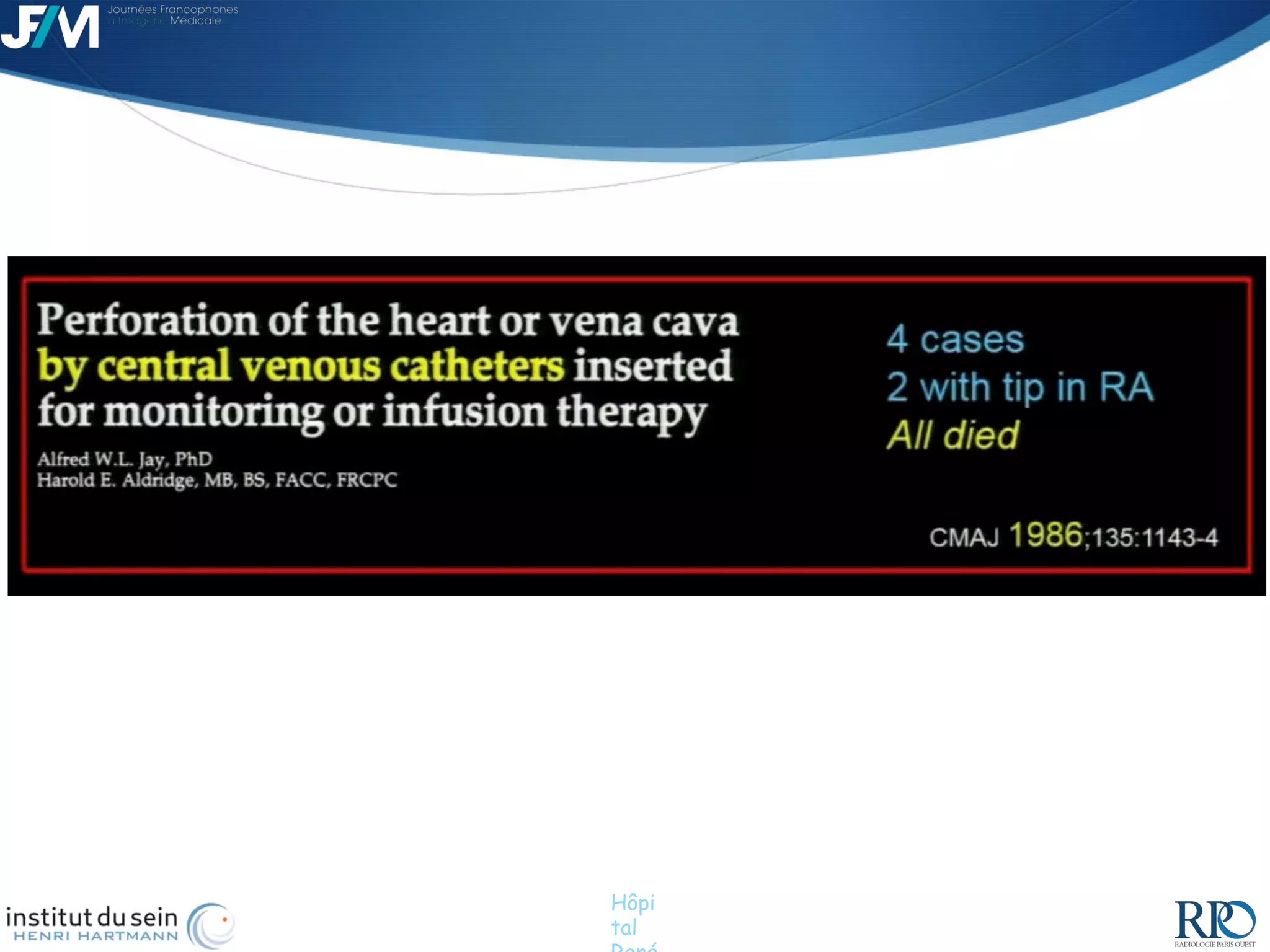 Catheter tip positioning control in chest port implantation. Luc ...