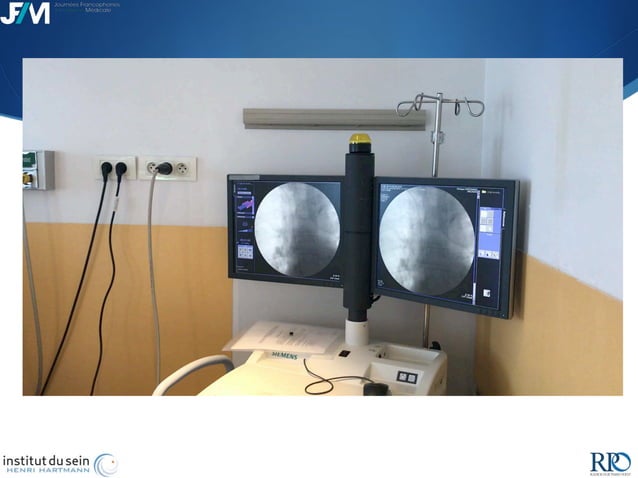 Catheter tip positioning control in chest port implantation. Luc ...