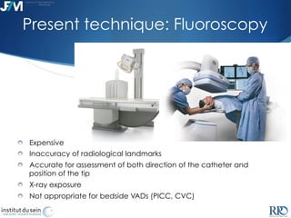 Catheter tip positioning control in chest port implantation. Luc ...