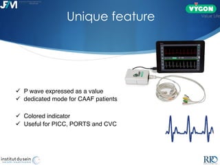 Catheter tip positioning control in chest port implantation. Luc ...