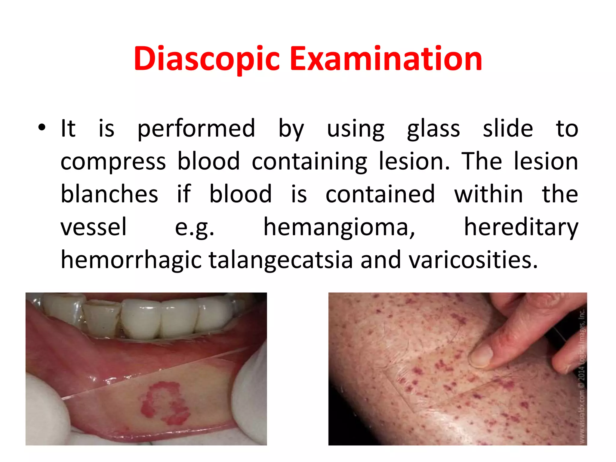 methods of clinical examination | PPTX
