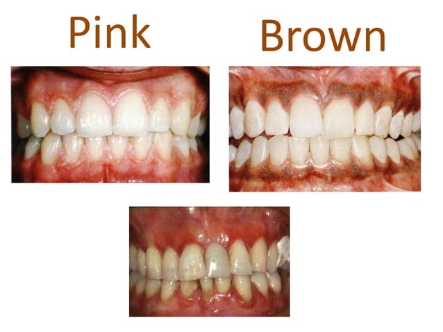 methods of clinical examination | PPTX