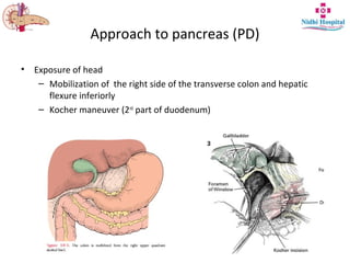 Resectional Anatomy of Pancreas | PPT