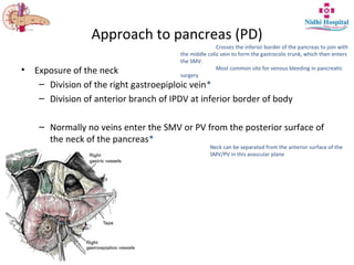 Resectional Anatomy of Pancreas | PPT