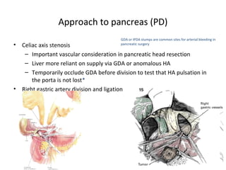 Resectional Anatomy of Pancreas | PPT