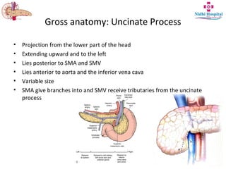 Pancreatic Anatomy Uncinate