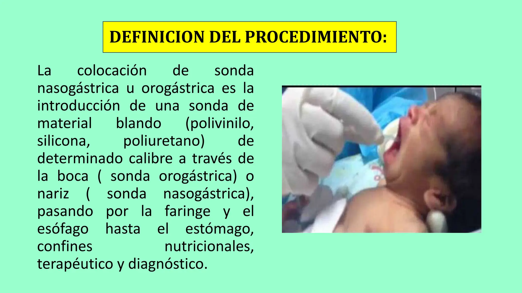 3 Colocacion Sonda Orogastrica Enfermeria Ppt Pptx