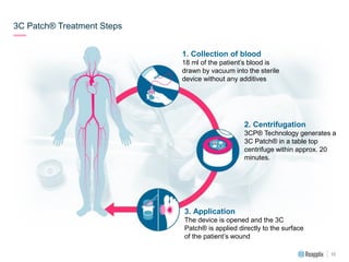 3C Patch therapy for hard-to-heal diabetic foot ulcers