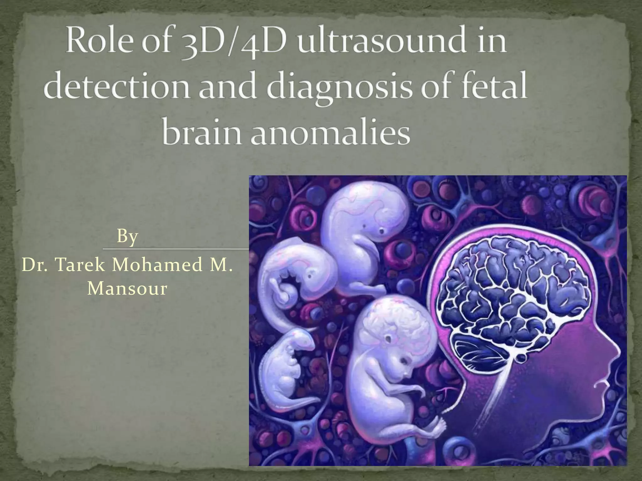 3D&4D brain anomalies | PPTX