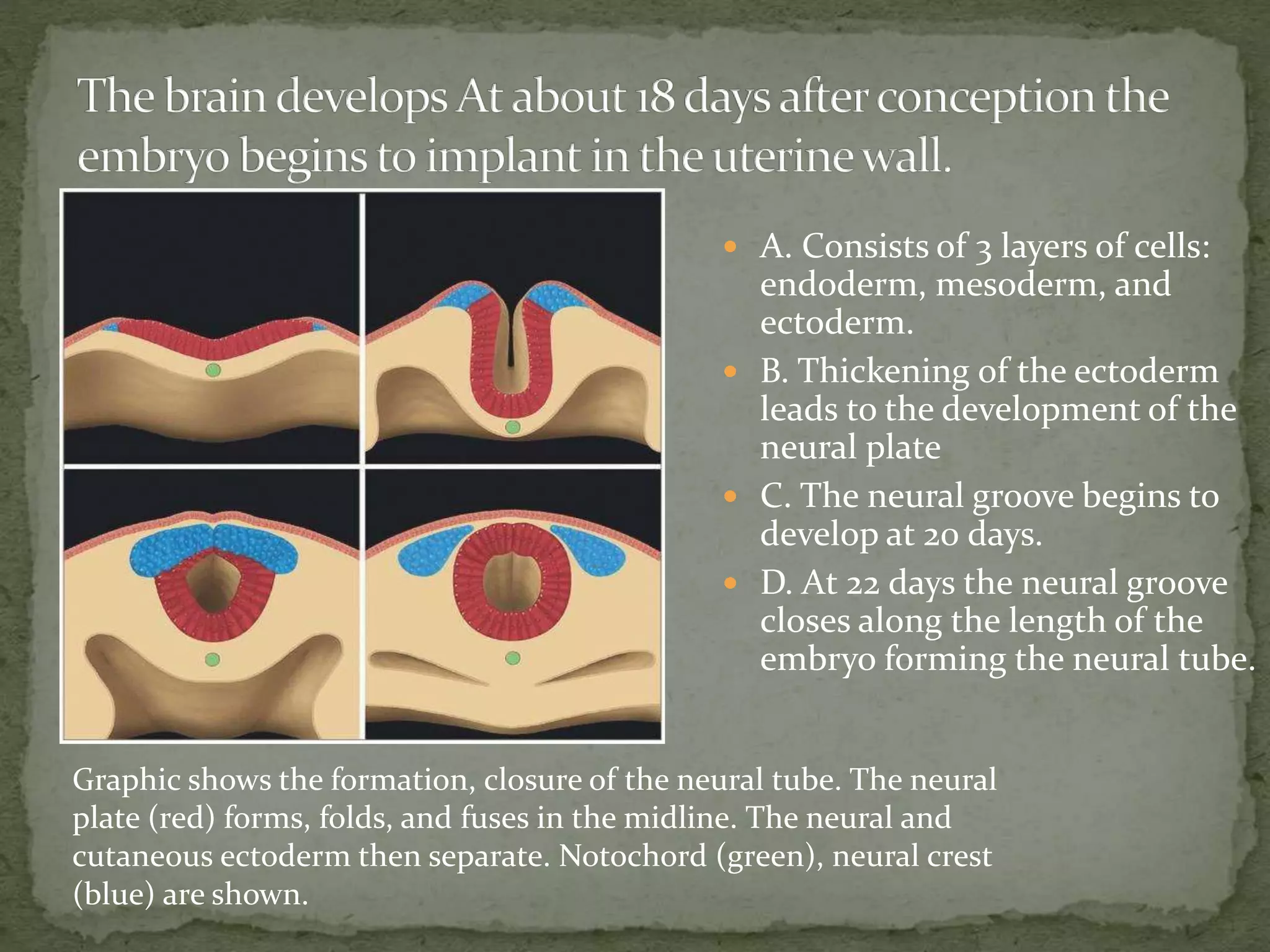 3D&4D brain anomalies | PPTX
