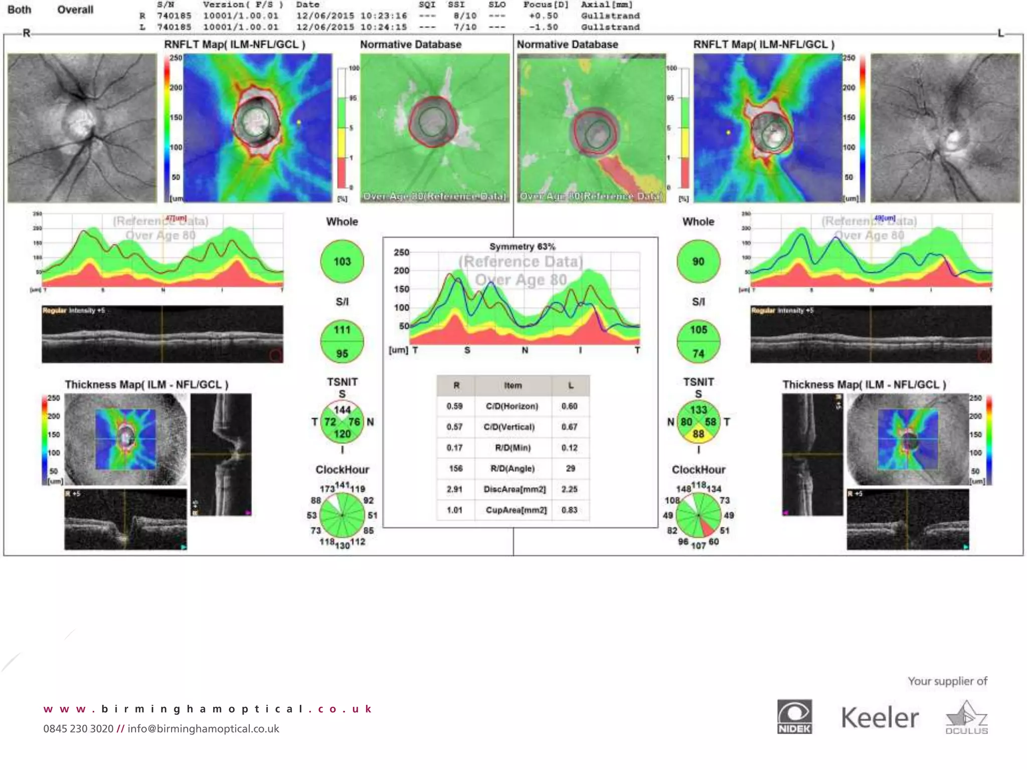 Glaucoma and OCT – Are Macula Scans More Valuable than Disc Scans | PPTX