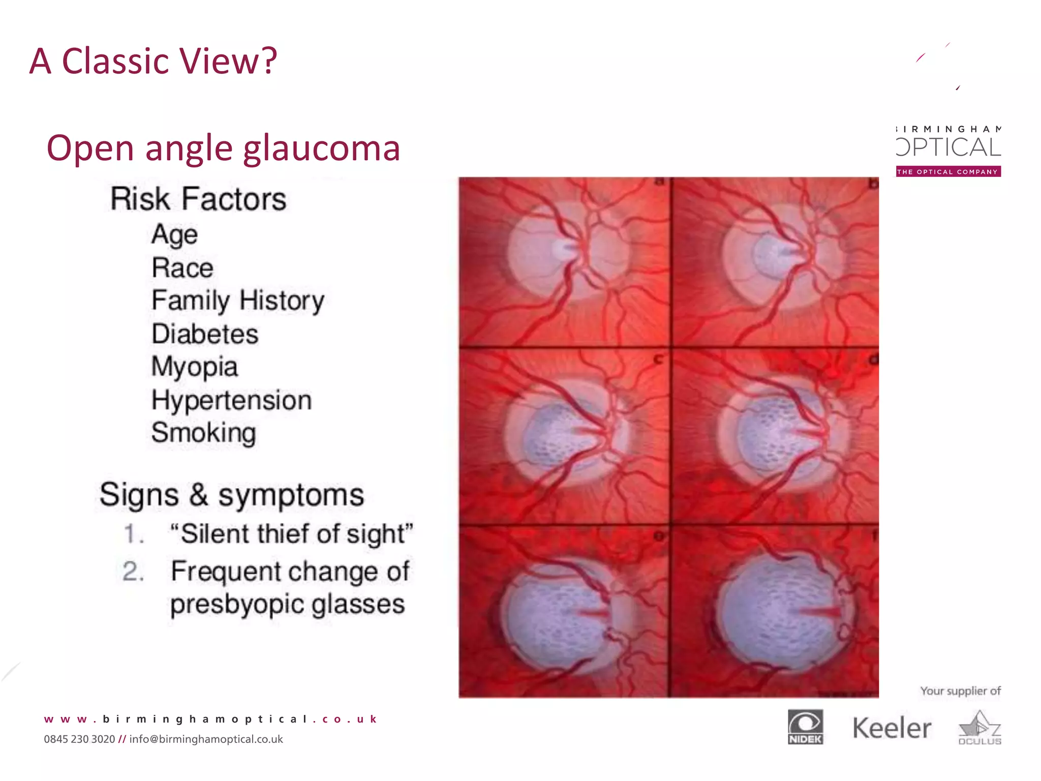 Glaucoma and OCT – Are Macula Scans More Valuable than Disc Scans | PPTX