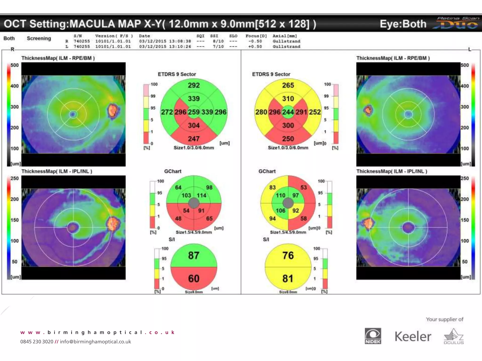 Glaucoma and OCT – Are Macula Scans More Valuable than Disc Scans | PPTX