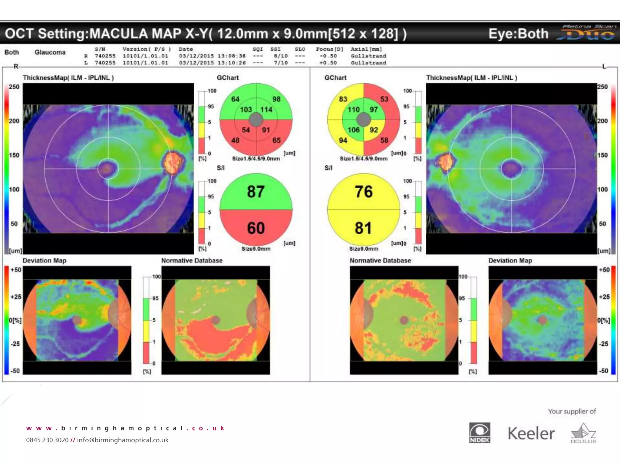 Glaucoma and OCT – Are Macula Scans More Valuable than Disc Scans | PPTX