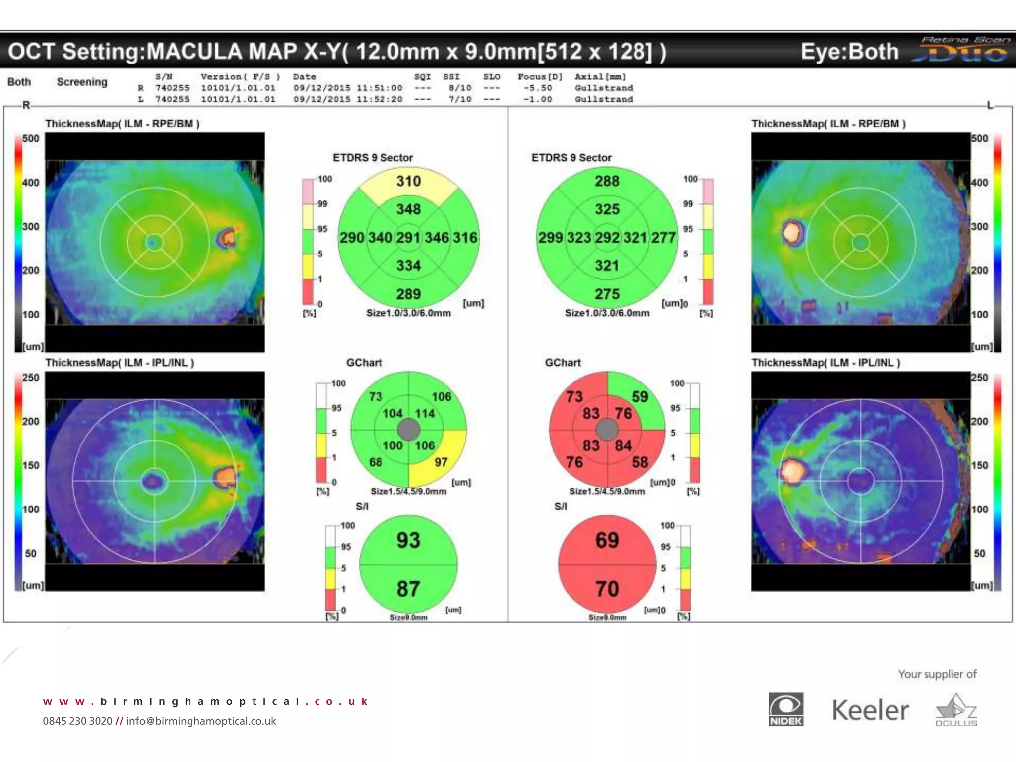 Glaucoma and OCT – Are Macula Scans More Valuable than Disc Scans | PPTX