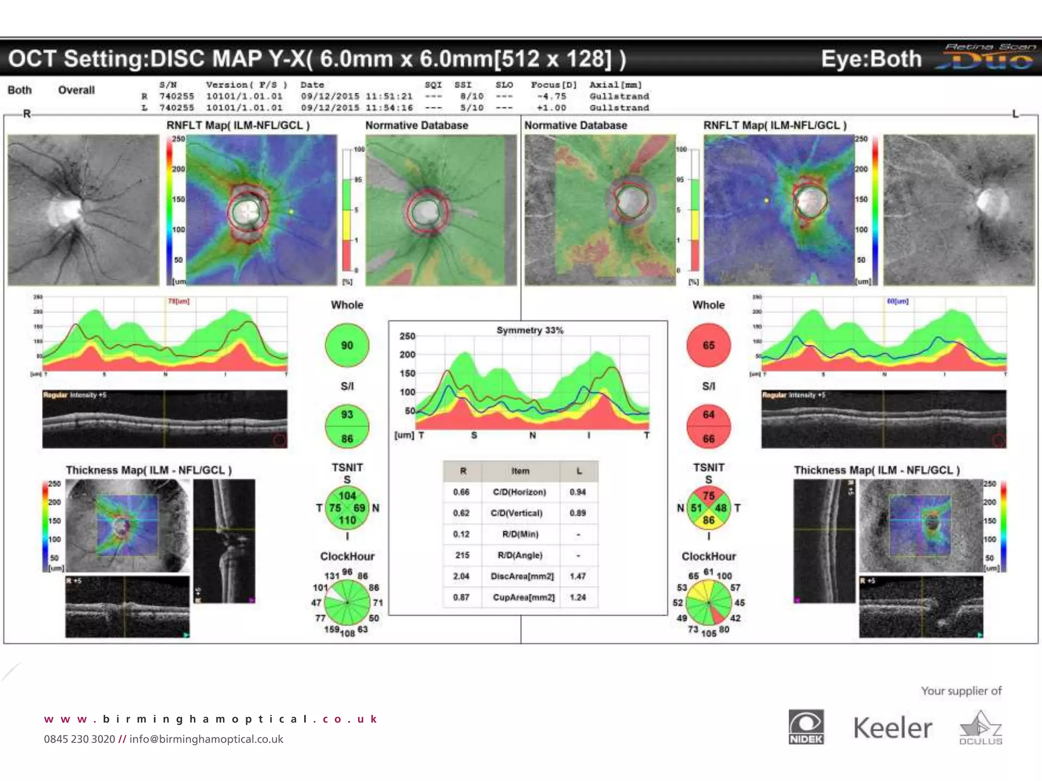 Glaucoma and OCT – Are Macula Scans More Valuable than Disc Scans | PPTX