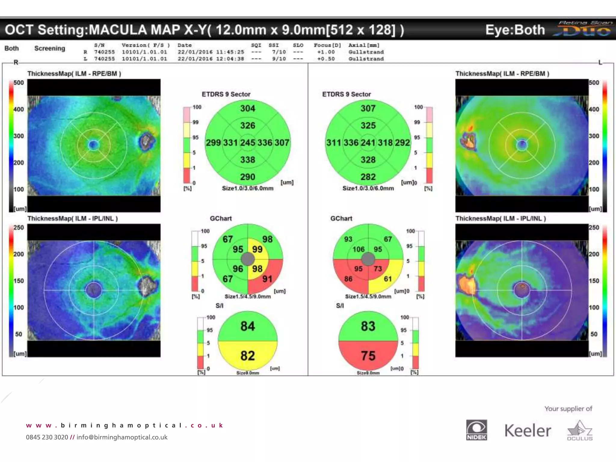 Glaucoma and OCT – Are Macula Scans More Valuable than Disc Scans | PPTX