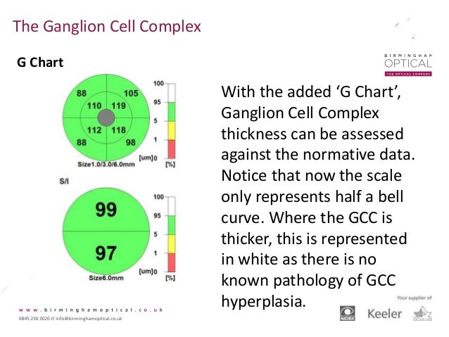 Glaucoma and OCT – Are Macula Scans More Valuable than Disc Scans