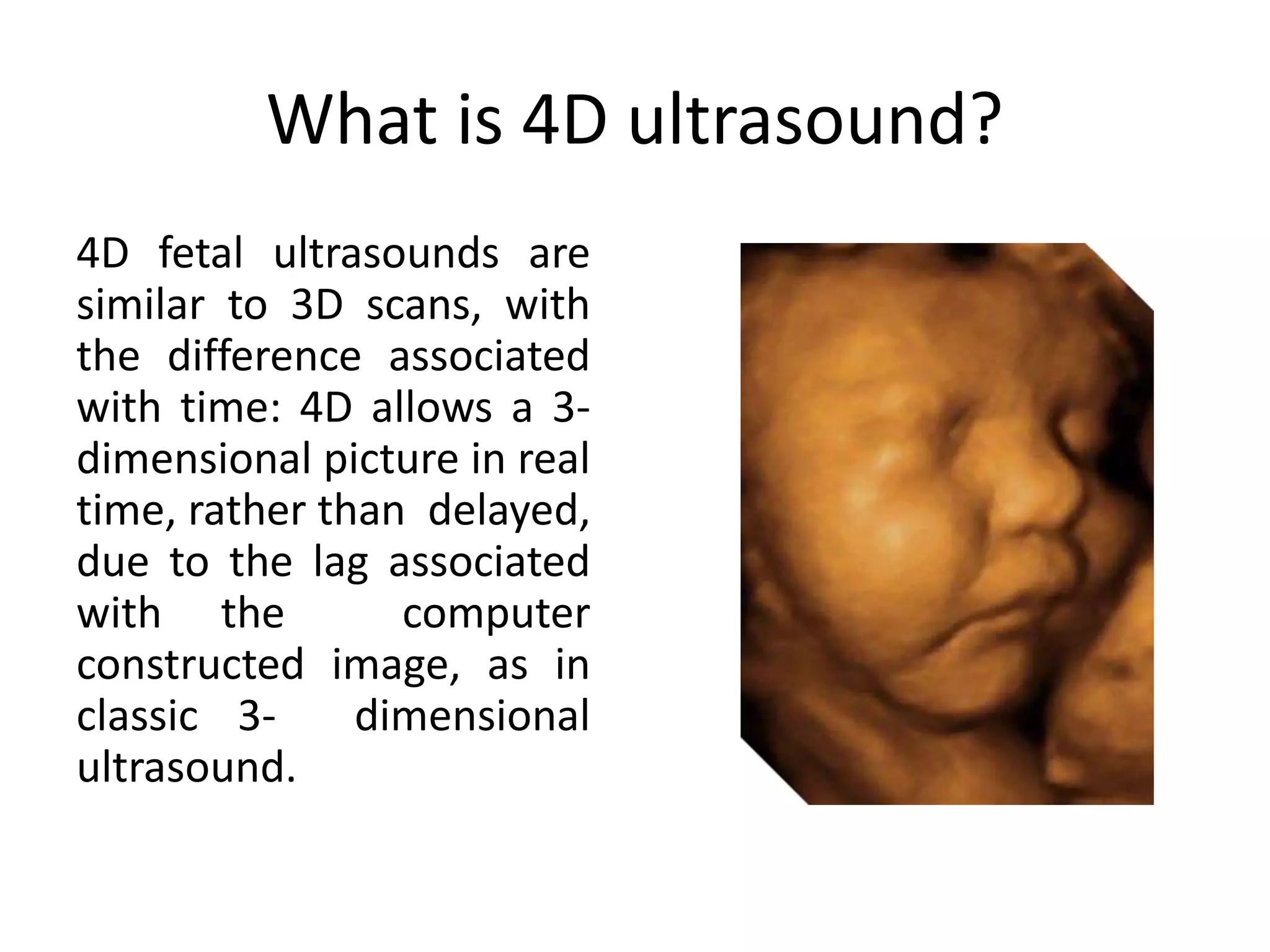 3D and 4D ultrasound in obstetrics | PPTX